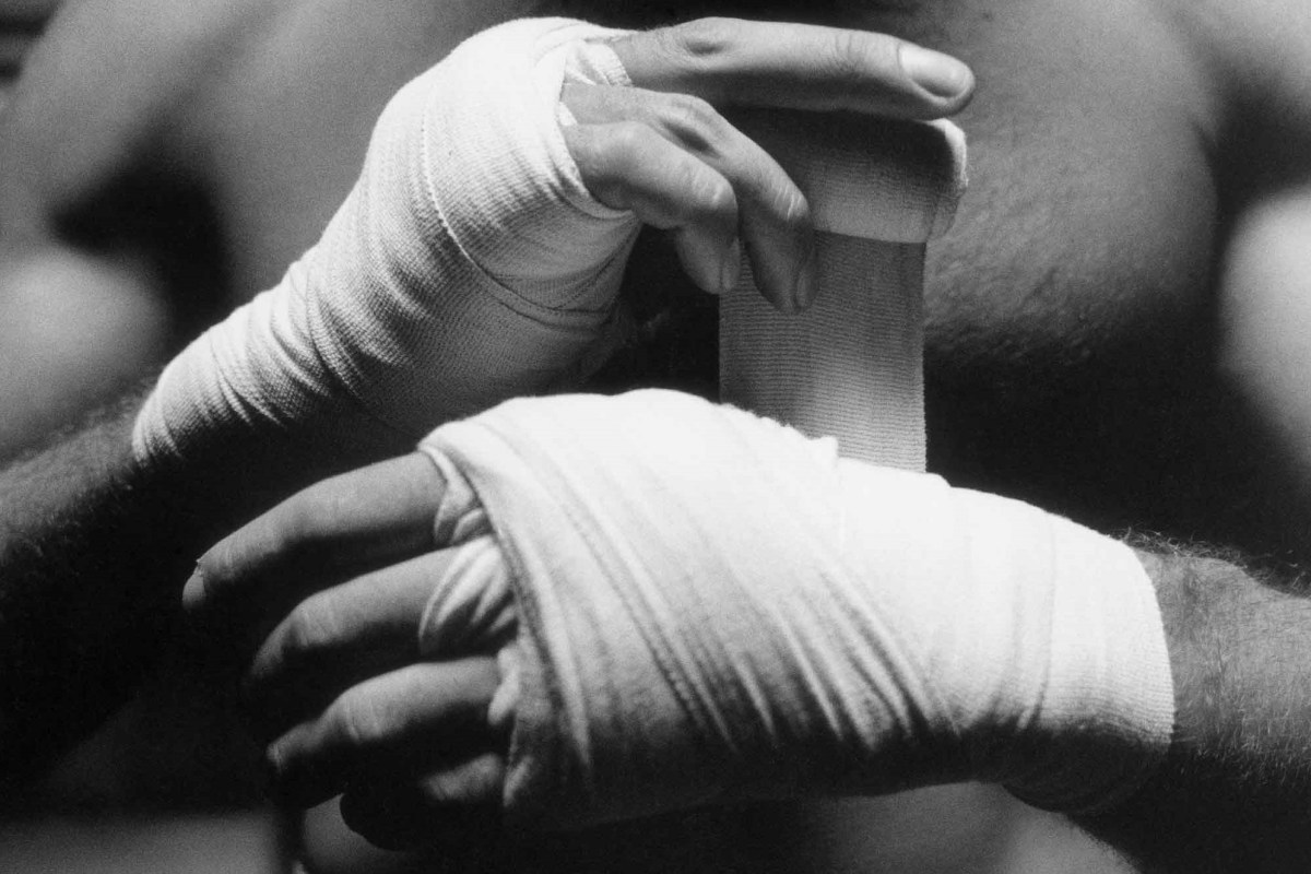 Closed Fist Injury – SR